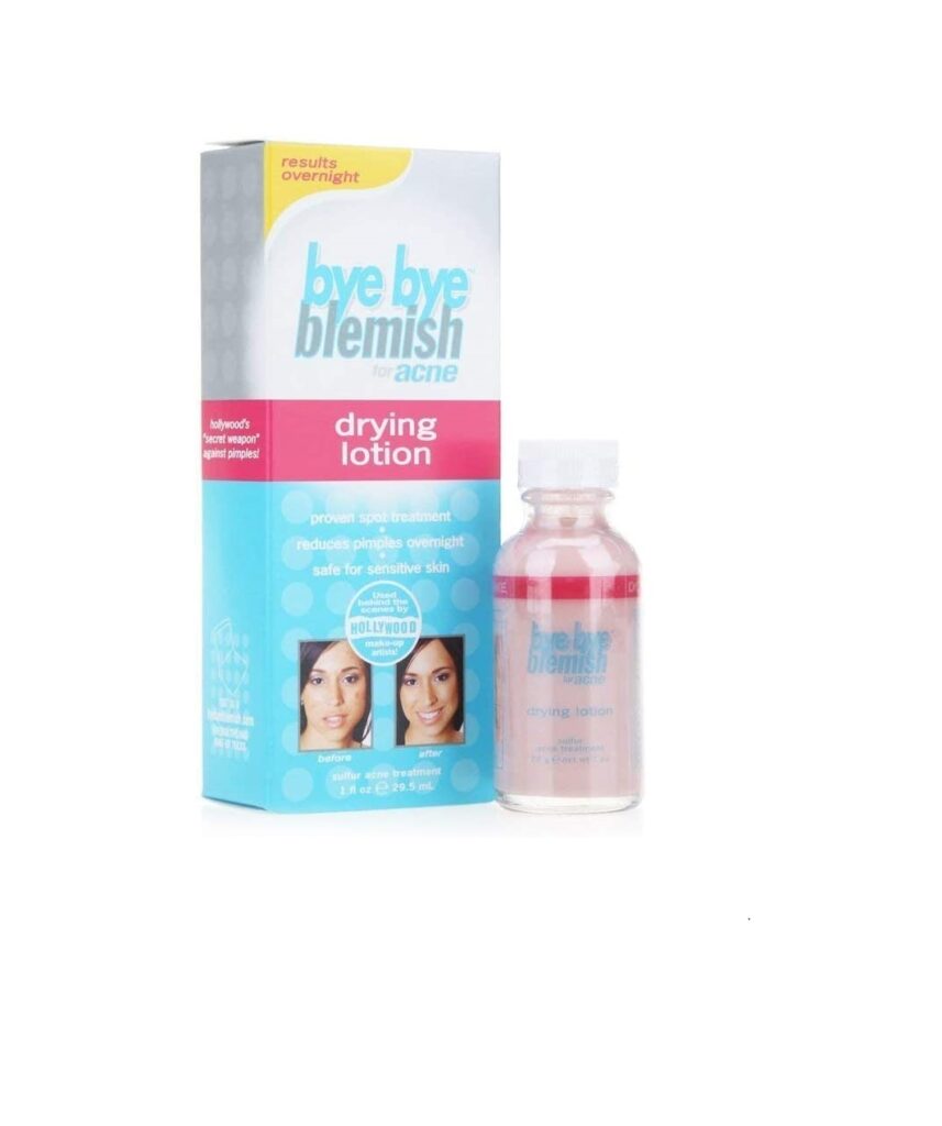Bye Bye Blemish Acne Drying Lotion, Reduce Pimples Overnight 1oz, *UK* - Online Mega Store